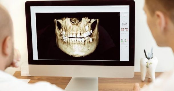 What Is CBCT Scan? Top FAQs for Dental Patients